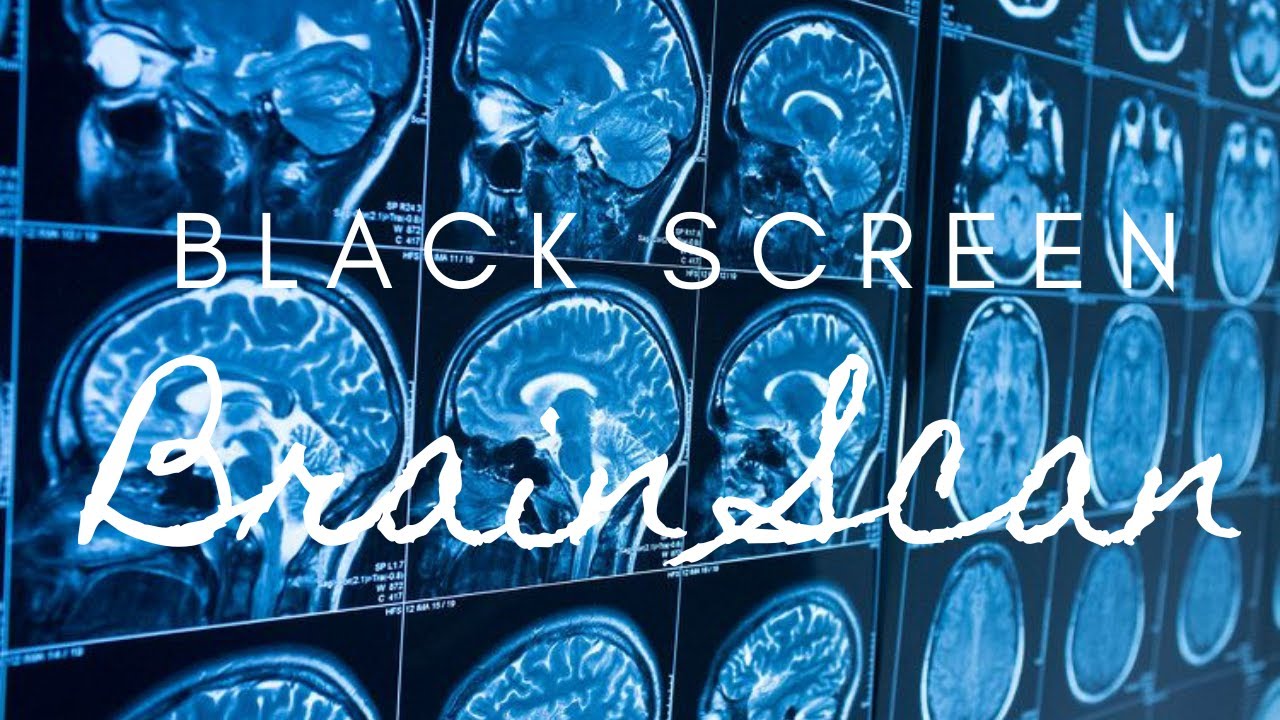 Brain Scan Sounds Black Screen for Sleep, 12 hours ~ NO ADS - YouTube