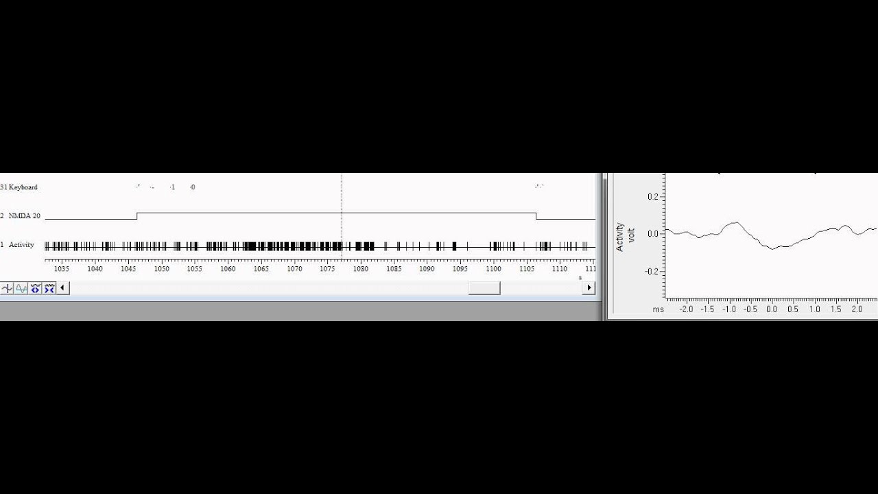 Dopamine neuron entering Depolarization Block - YouTube