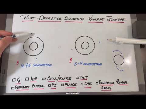 Post-Operative Evaluation for the Yamane Technique