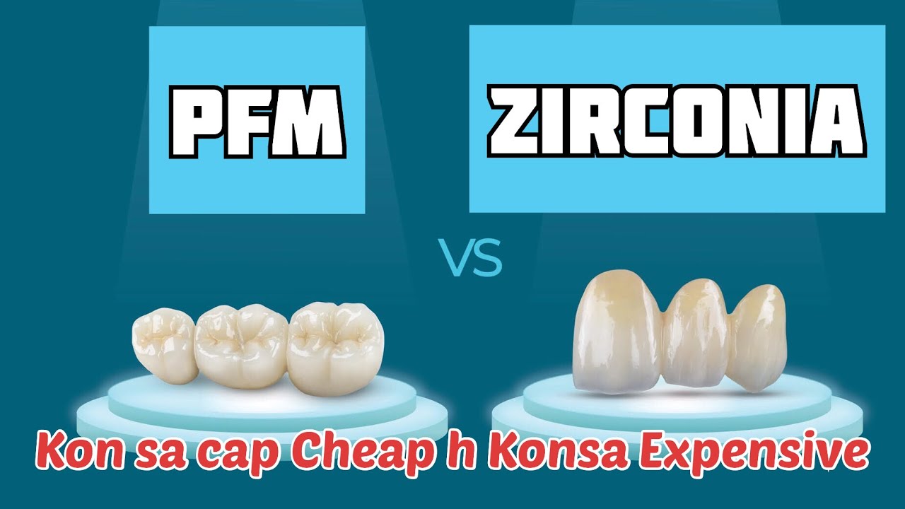 Zirconia cap vs PFM cap. Konsa sa cap cheap or Konsa expensive. Which ...