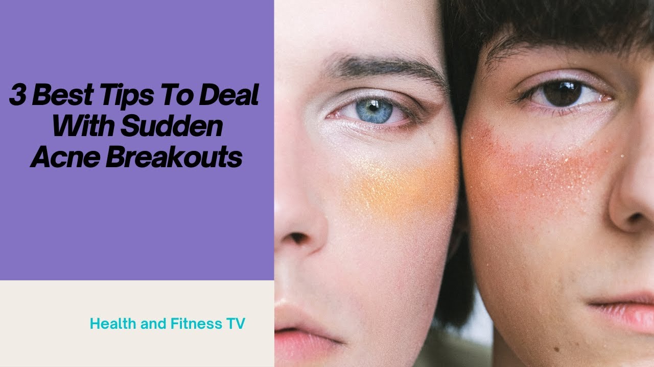 3 Best Tips To Deal With Sudden Acne Breakouts udden - YouTube