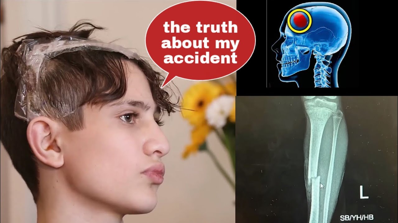 Nidal Wonder explained how the accident happened - YouTube