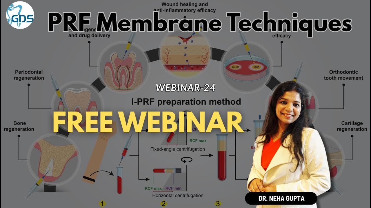Webinar 24 | PRF Membrane Techniques for Implant Success | Join free ...