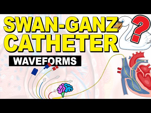 Pulmonary Artery (PA) Catheter Waveforms EXPLAINED!
