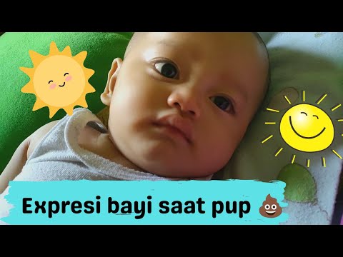 Expresi Lucu Bayi Saat Bab ( buang air besar) di popok #bayilucu #babyboy #abizardaily