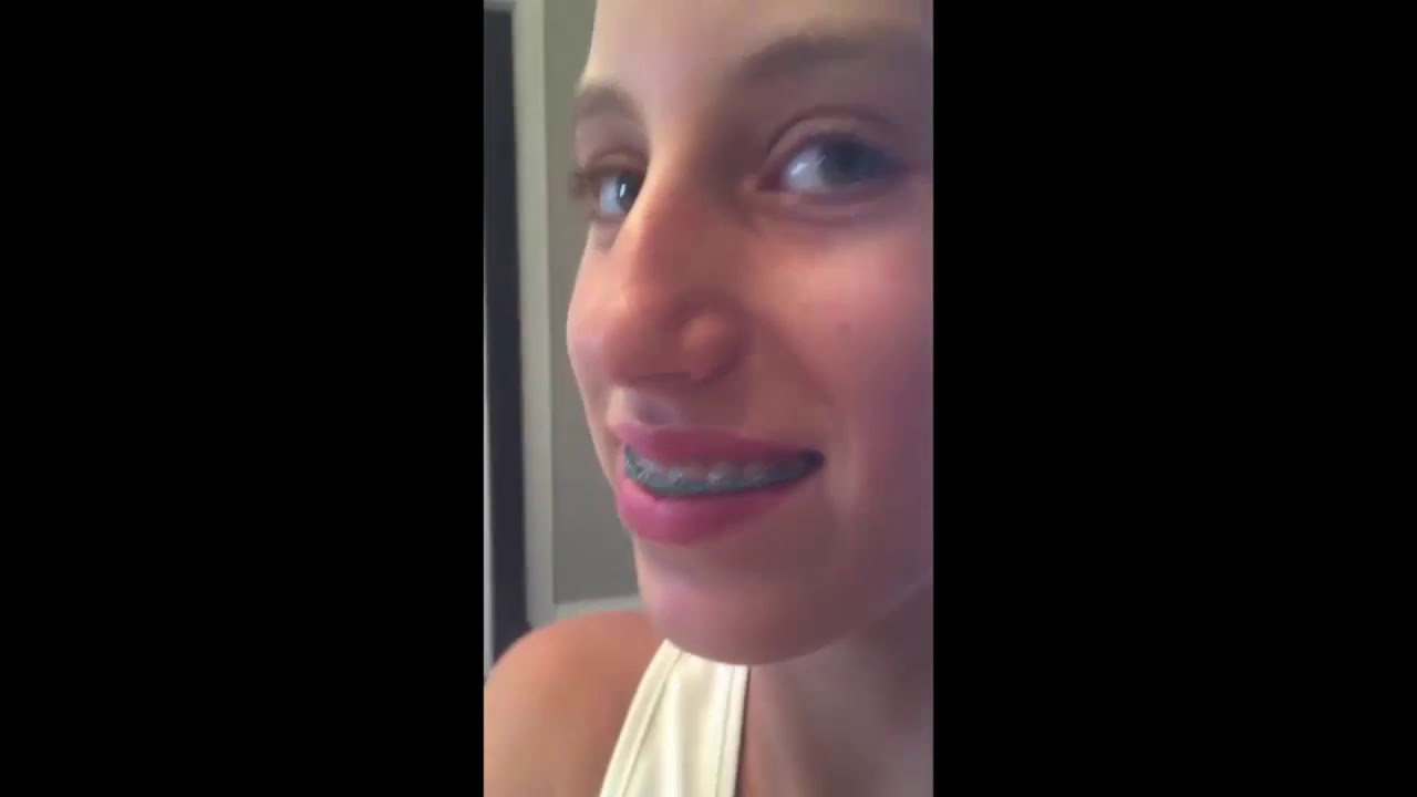 Ear Cyst Popping - Original File [1080p] - YouTube