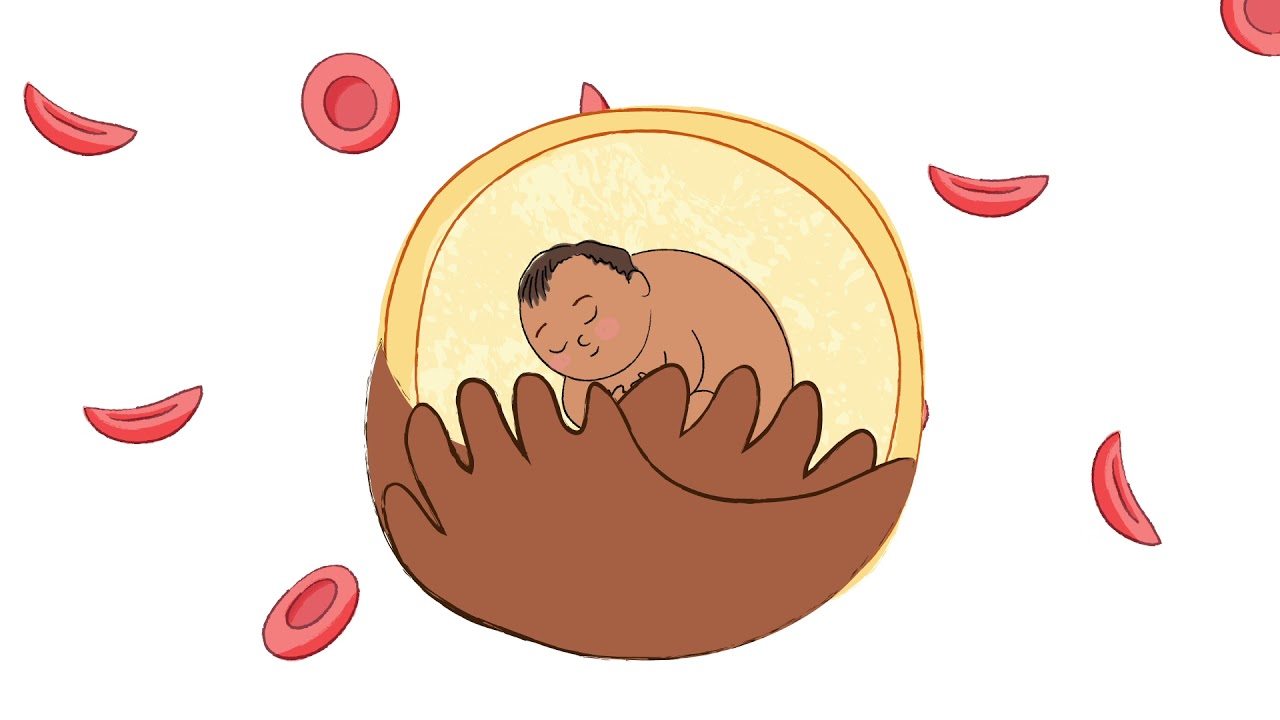 Sickle Cell Anaemia Cartoon What Is Sickle Cell? | Sickle Cell Speaks