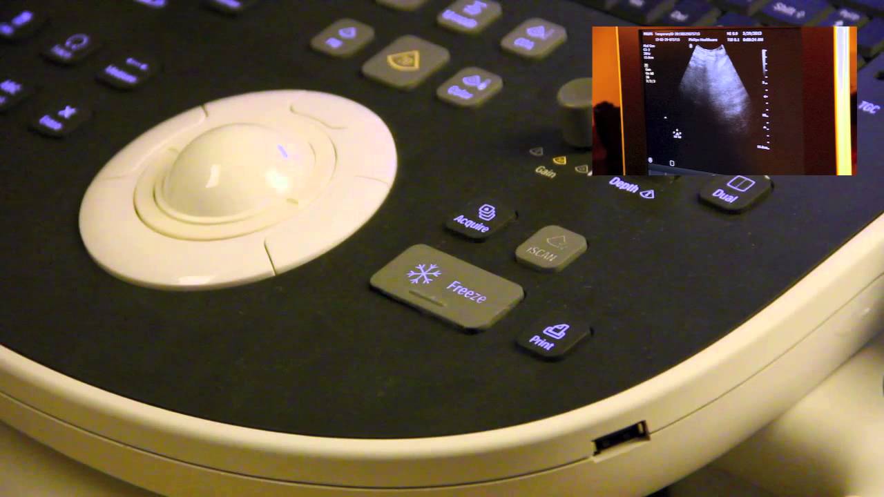 Freeze Button in US Machine - YouTube