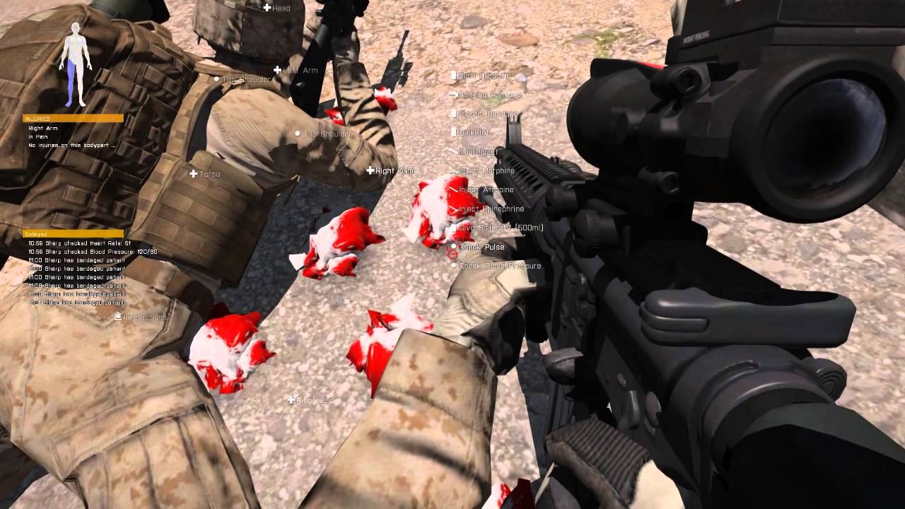 European Tactical Realism - ACE 3 (Advanced) Medical Highlights - YouTube