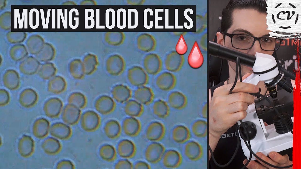 Blood Cells Under DIY Video Microscope - YouTube