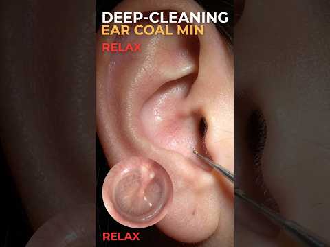 #149  Deep Relaxing With Hard Working of Removal Ear Wax #satisfying #relaxing #video