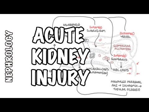 Acute Kidney Injury (AKI)prerenal, and postrenal causes and ...