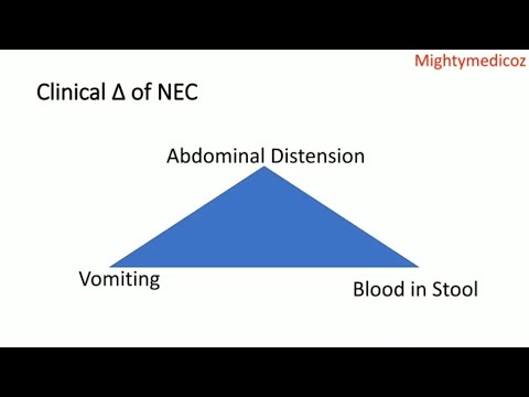 Clinical Triad of NEC| Necrotizing EnteroColitis | Triad ...