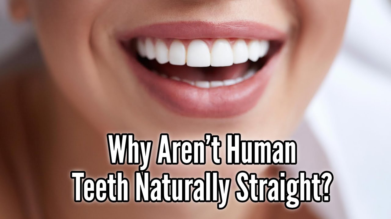 Why Aren’t Human Teeth Naturally Straight? - YouTube