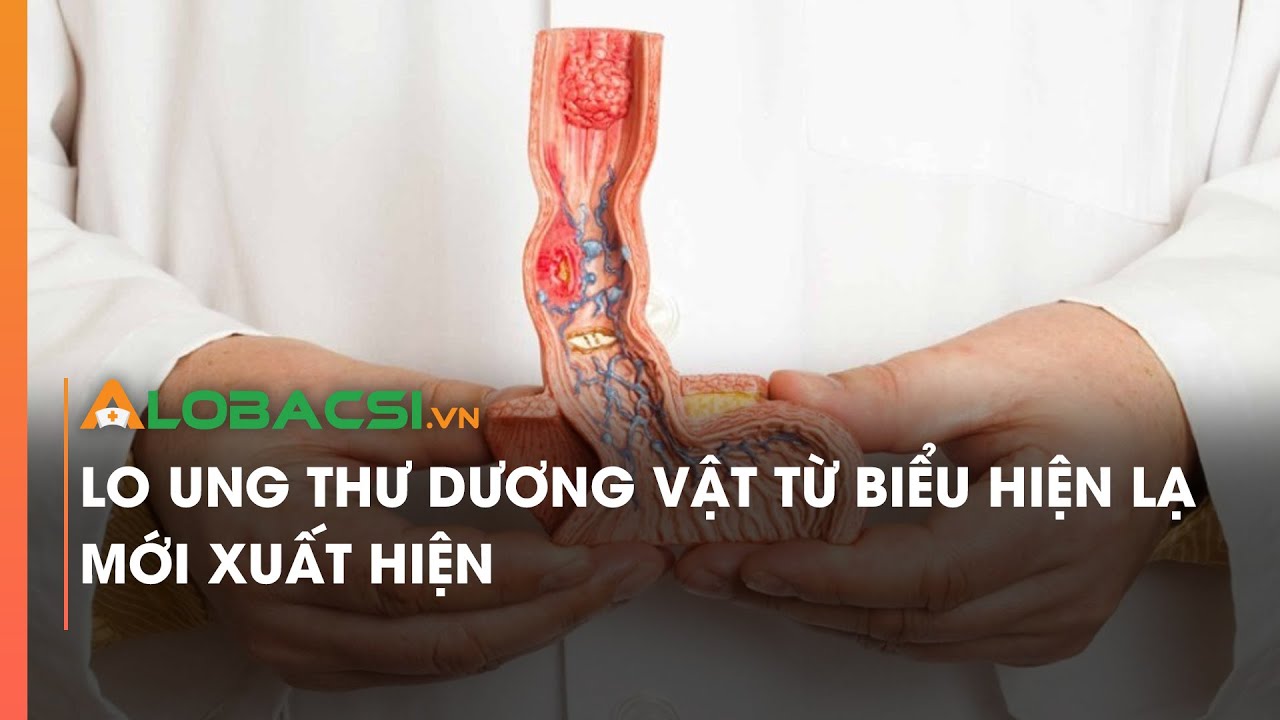 Lo Ung Thư Dương Vật Từ Biểu Hiện Lạ Mới Xuất Hiện Youtube