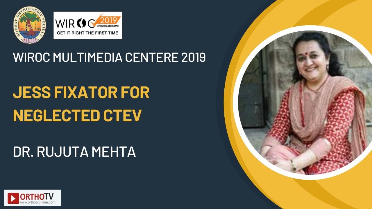 Jess fixator for Neglected CTEV - Dr. Rujuta Mehta - YouTube