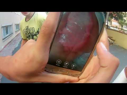 VLOG -TEK TEKER- BMX DEN DÜŞEN ÇOCUK-TEK TEKER FULL-