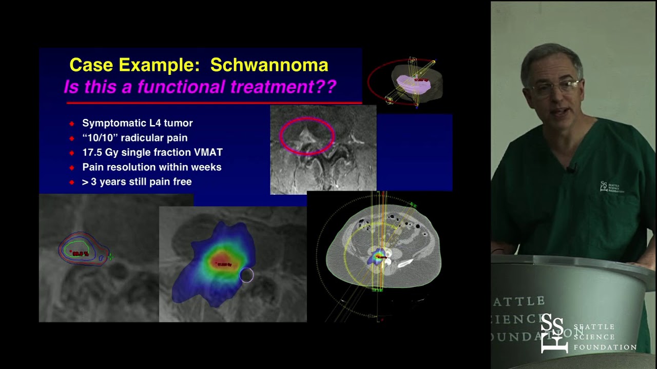 Radiosurgery for Treatment of Benign Tumors of the Spine - Peter C ...