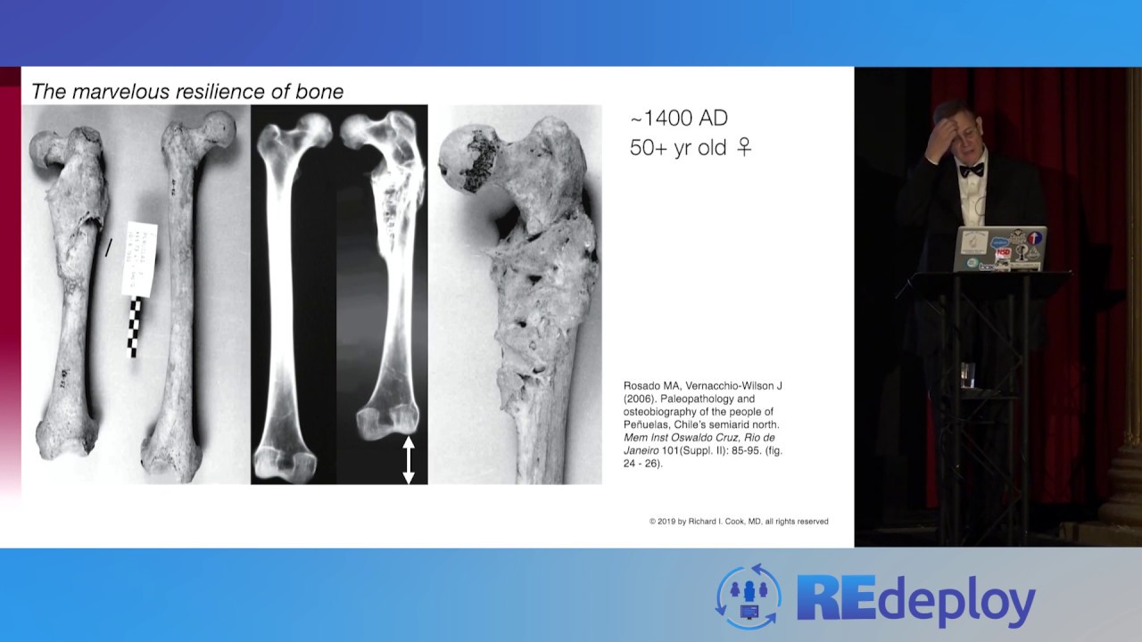A Few Observations on the Marvelous Resilience of Bone & Resilience ...