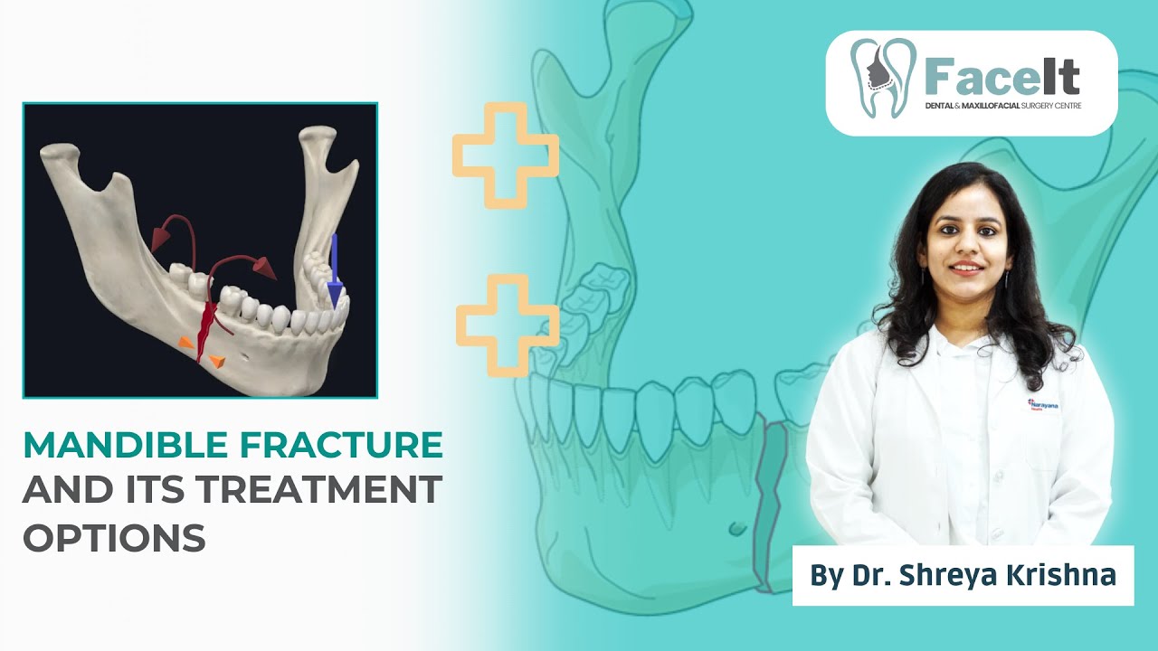 Mandible Fracture And Its Treatment Options | Jaw Fracture Repair ...