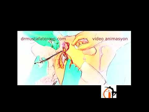 Meme küçültme bilgilendirme video form