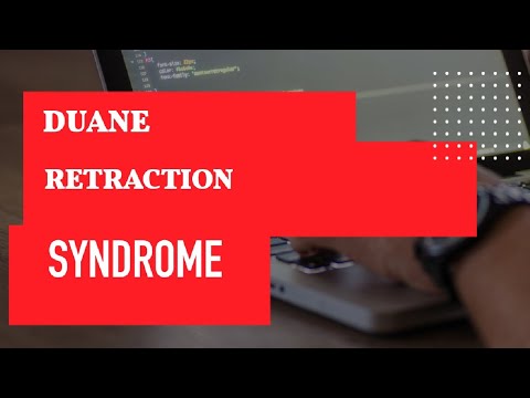 Duane Retraction Syndrome #optometry #youtube #duaneretractionsyndrome ...