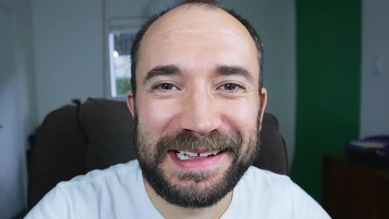 Craig After Dentist - YouTube