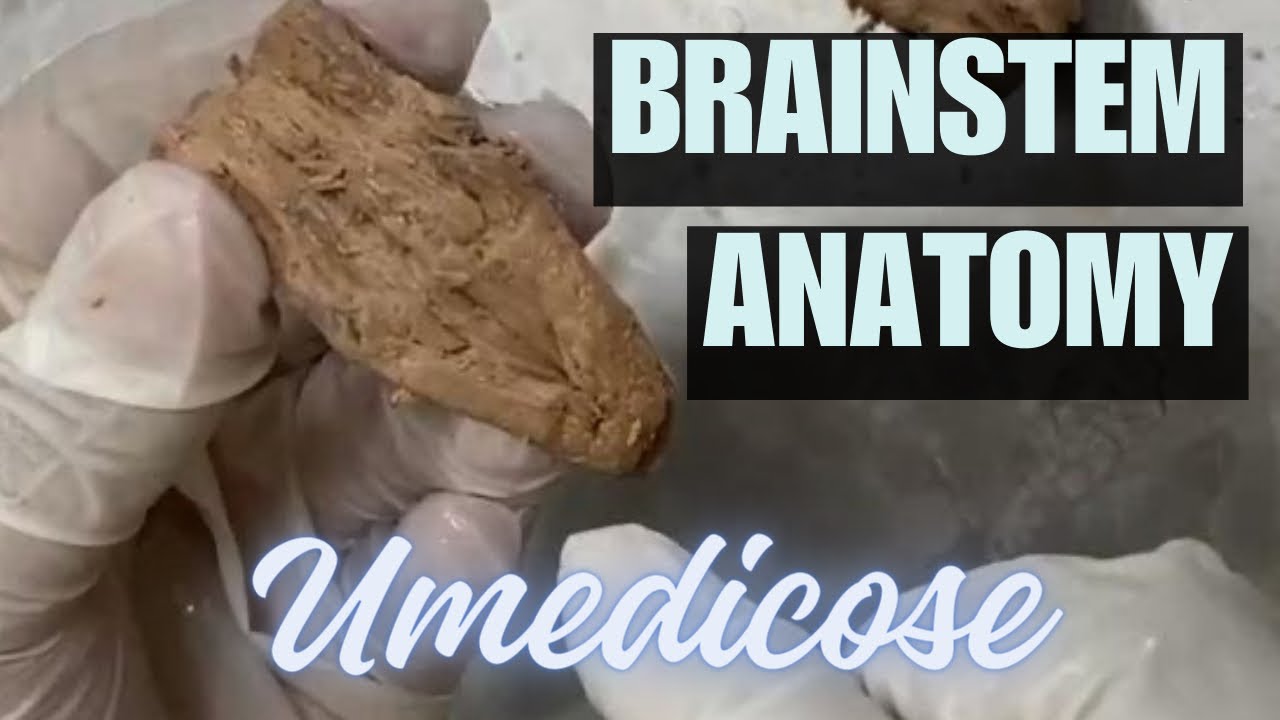 Brainstem model anatomy ospe || Umedicose - YouTube