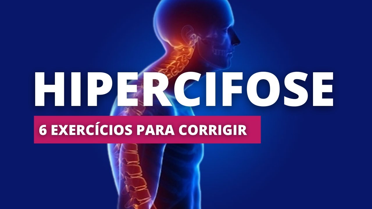 Como corrigir a postura corcunda (6 Exercícios) PILATES NA PAREDE ...