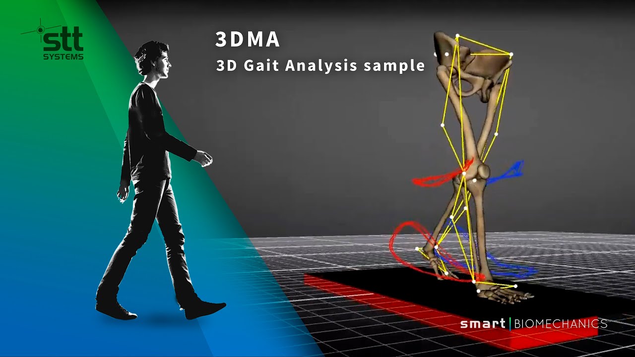 3D Gait Analysis sample | 3DMA - YouTube