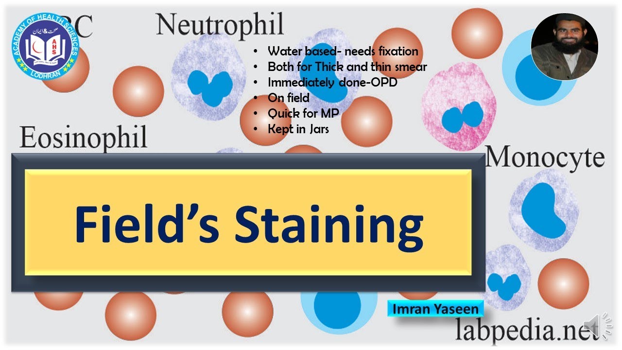 Field's stain: Water based Romanowsky stains needs fixation ...
