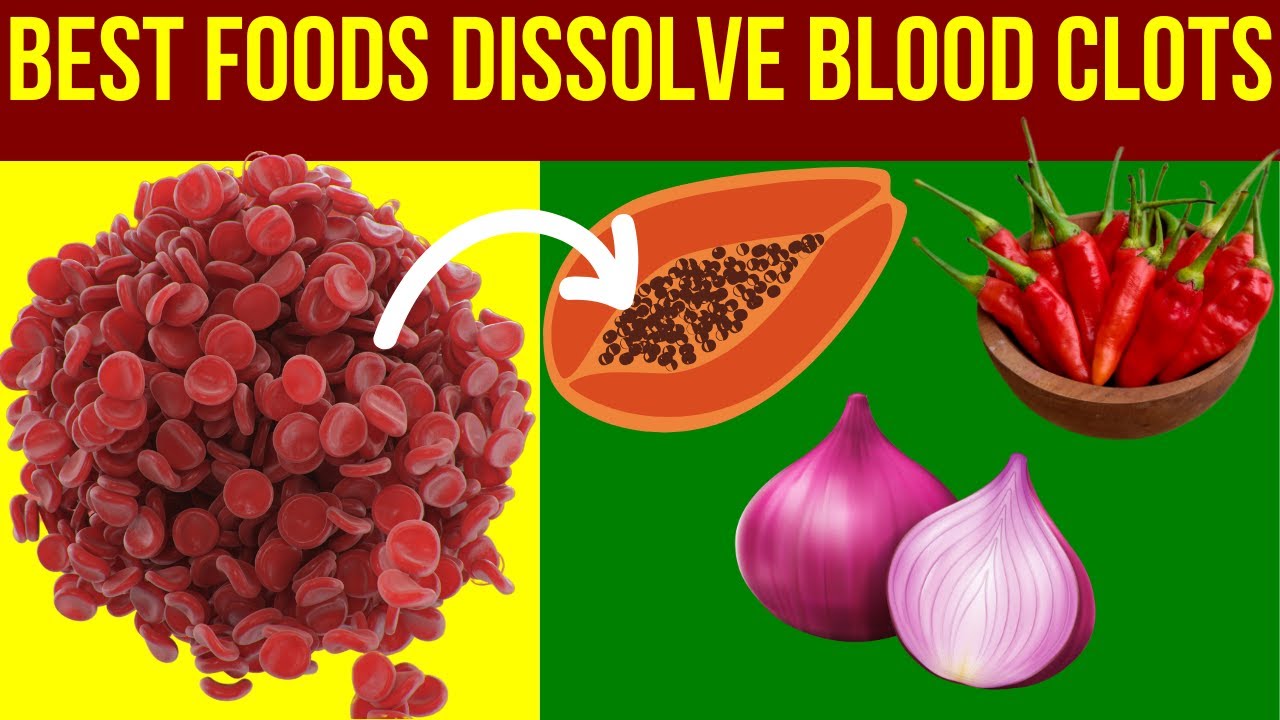 12 Foods That Dissolve Blood Clots Naturally (Doctors WON'T Tell You ...