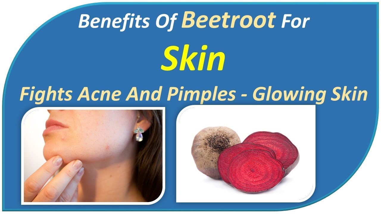 Benefits of Beetroot for Skin | fights acne and pimples - glowing skin ...