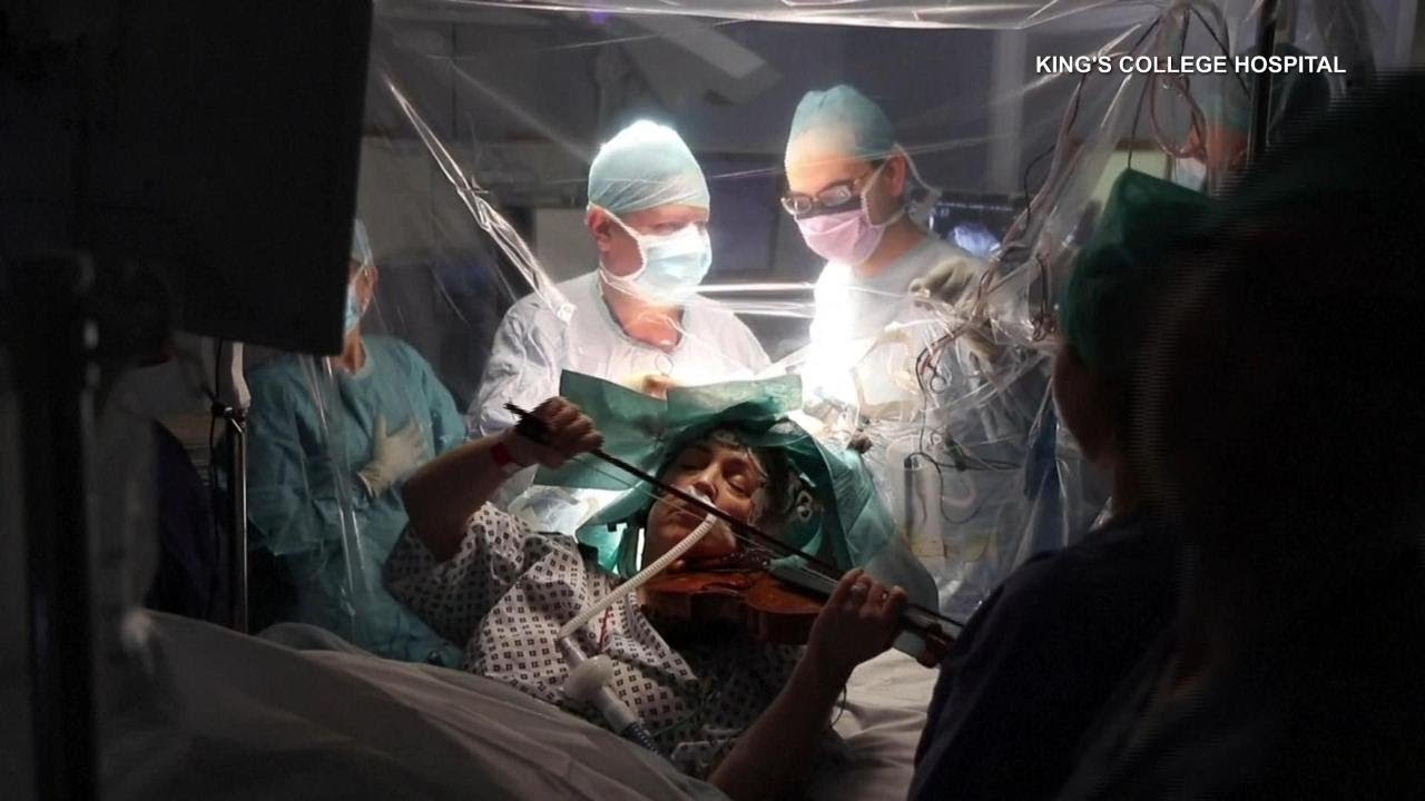 Patient plays violin during unusual brain surgery at U.K. hospital ...
