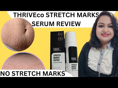 No More Stretch Marks: Reviewing THRlVEco Expert Serum Cream| Say ...