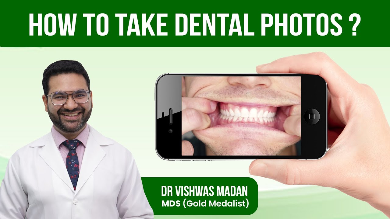 How to take Dental Photos ? Dental Photography | Dental Photography ...