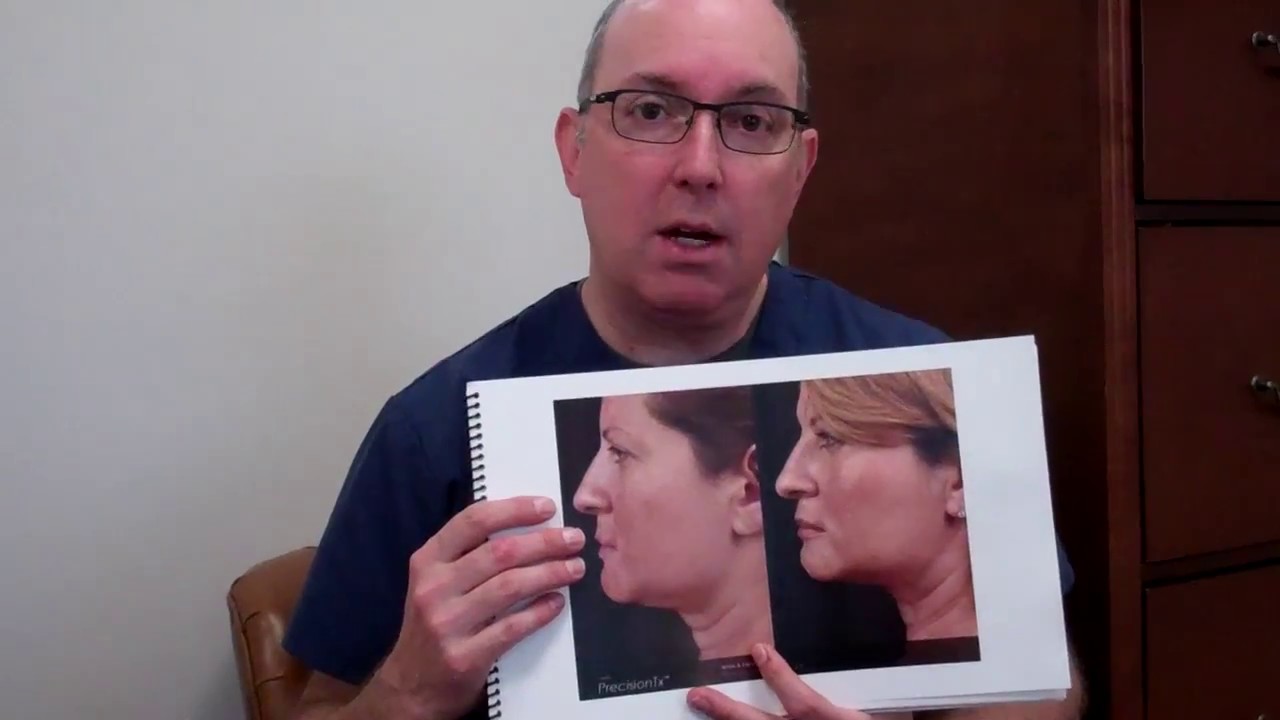 Improve Your Sagging Neck with our best technology to date: Precision ...