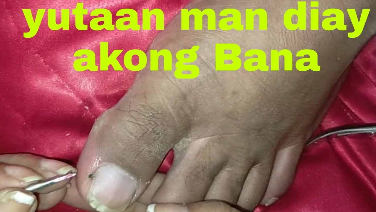 Dakong yuta ang akong bahin😂..Nisakit akong kamot pag limpyo.. - YouTube