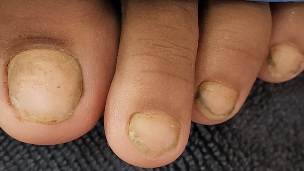 First time mag palinis ng kuko.Subrang madumi - YouTube