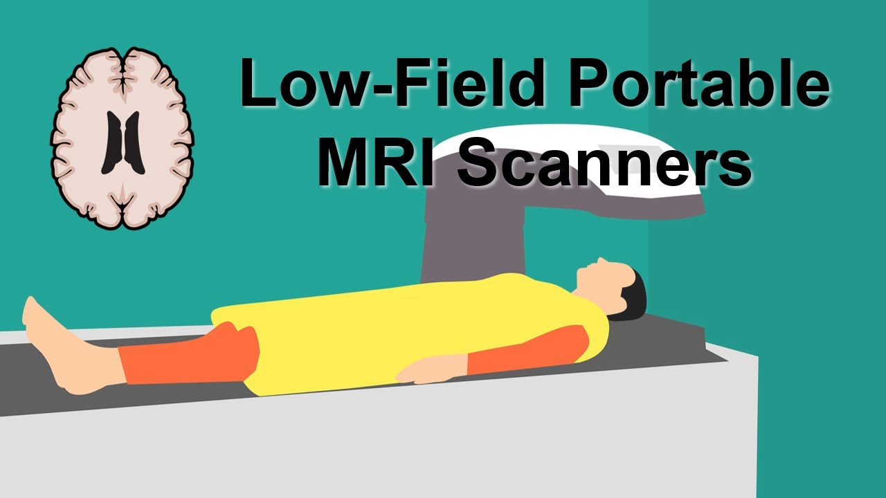 The Future of MRI: Low-Field Portable Scanners! - YouTube