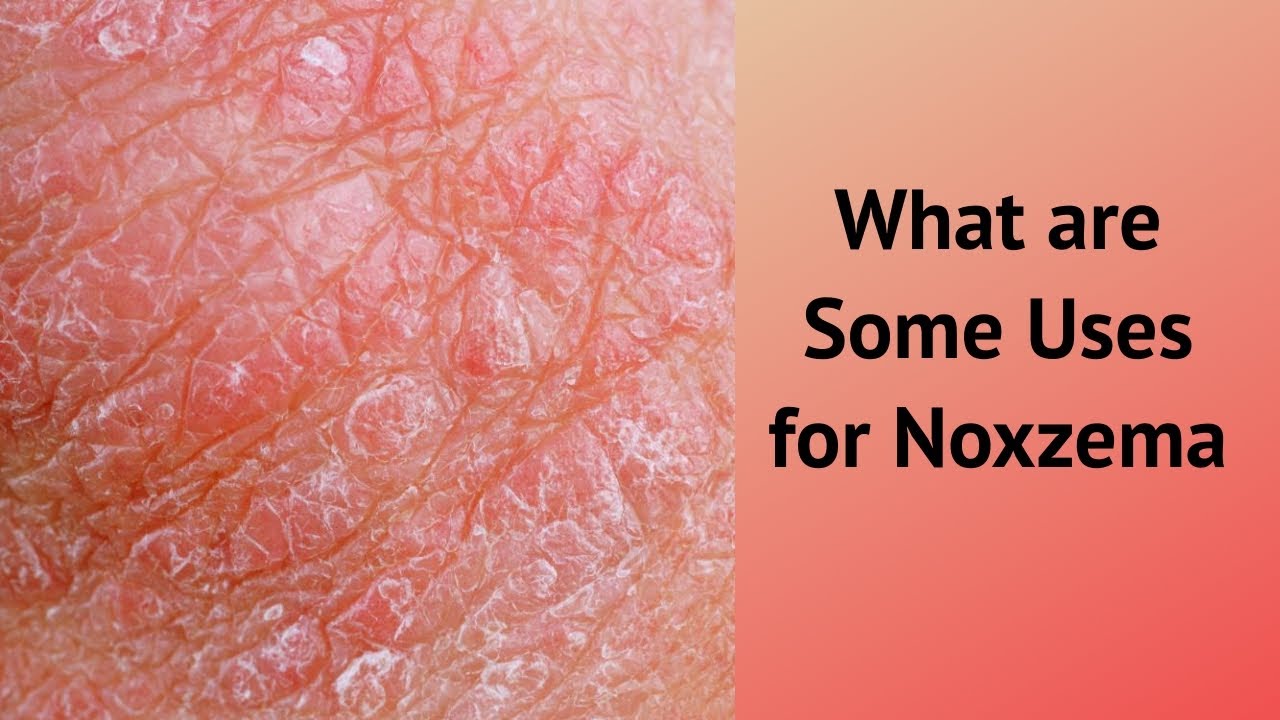 What are Some Uses for Noxzema - YouTube