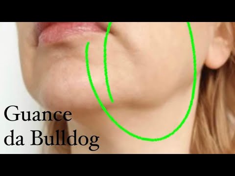 Come eliminare le guance da bulldog in una settimana? - YouTube