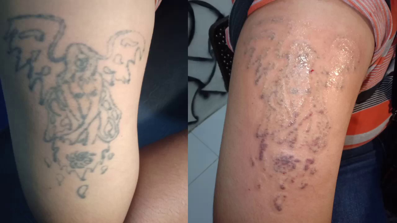 Video Hapus Tattoos