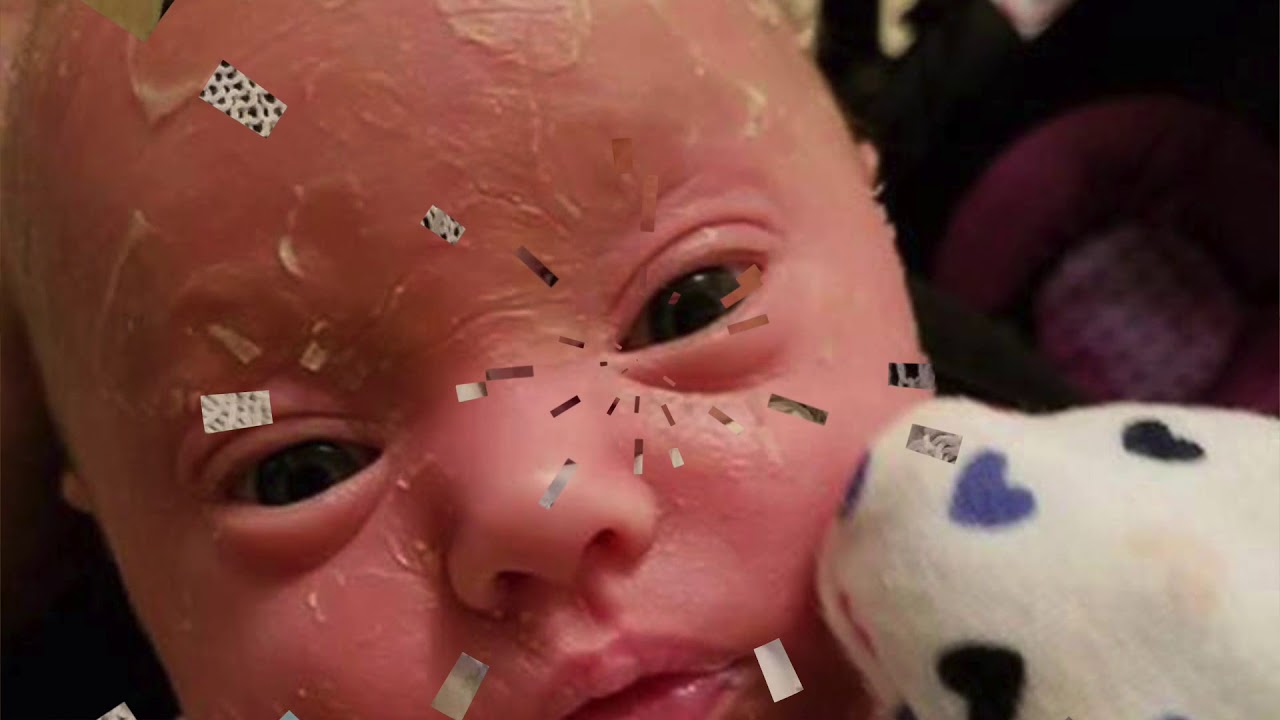 Young Mother Faces Backlash For Bathing Her Baby Daughter In Bleach ...