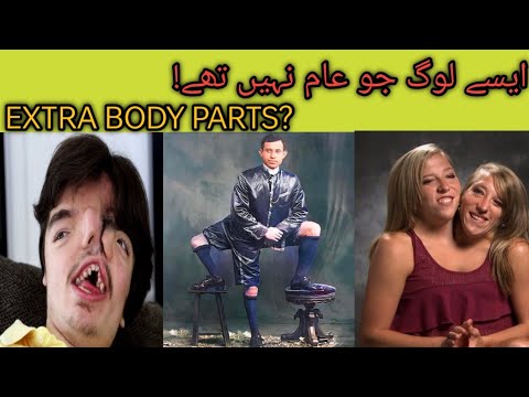 10 People With Extra Body Parts That Science Can’t Explain | Mystery ...