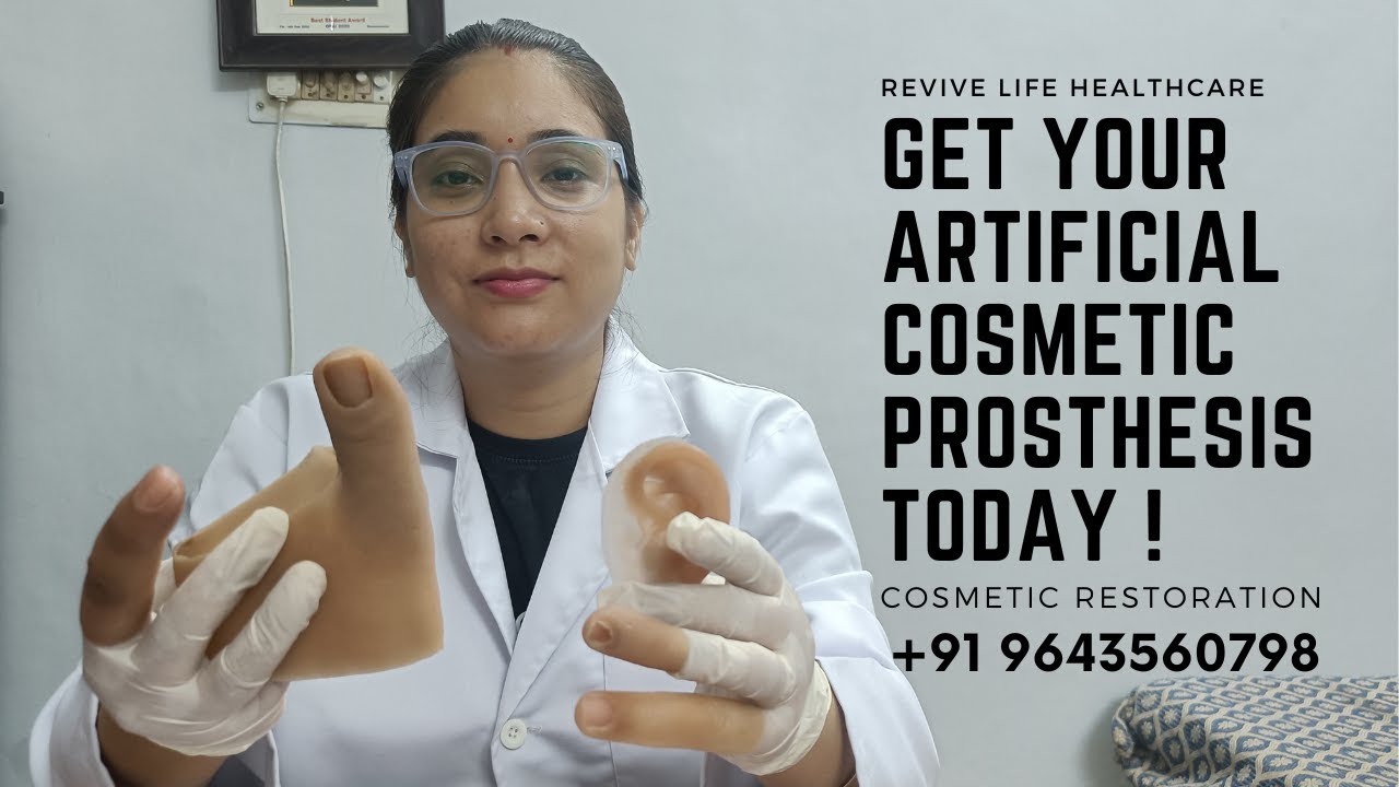 Cosmetic Restoration l Silicone Prosthesis l Artificial l Silicone l Finger l Toe l Ear l Nose ...