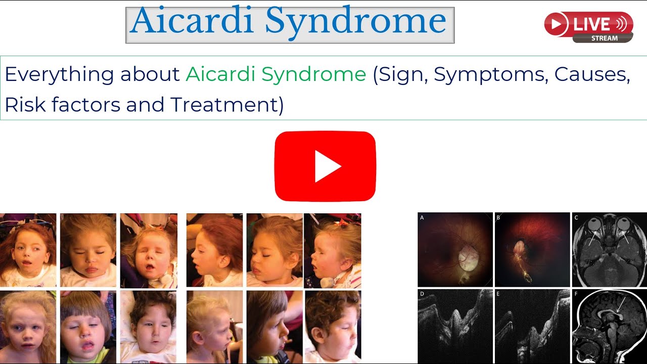 Aicardi Syndrome- Sign, Symptoms, Causes, Risk factors and Treatment ...