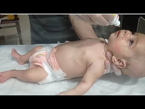 Newborn Baby Feeding Trial | Oral Drops & Chest Physiotherapy | NICU ...