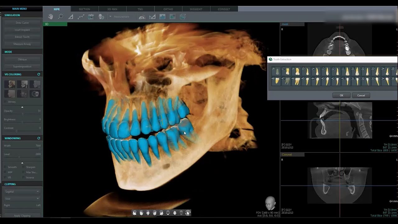 Ez3D-i 5.1 Teaser Video - YouTube