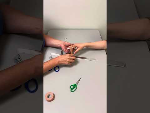 Zimmer splint use in fractures of the hand - YouTube
